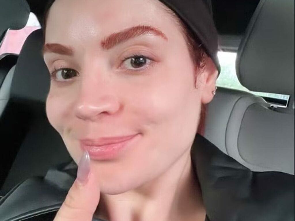 Gkay Retira Mais Um Procedimento Estético Por Visual Mais ‘natural ‘não Estranhem O Tempo